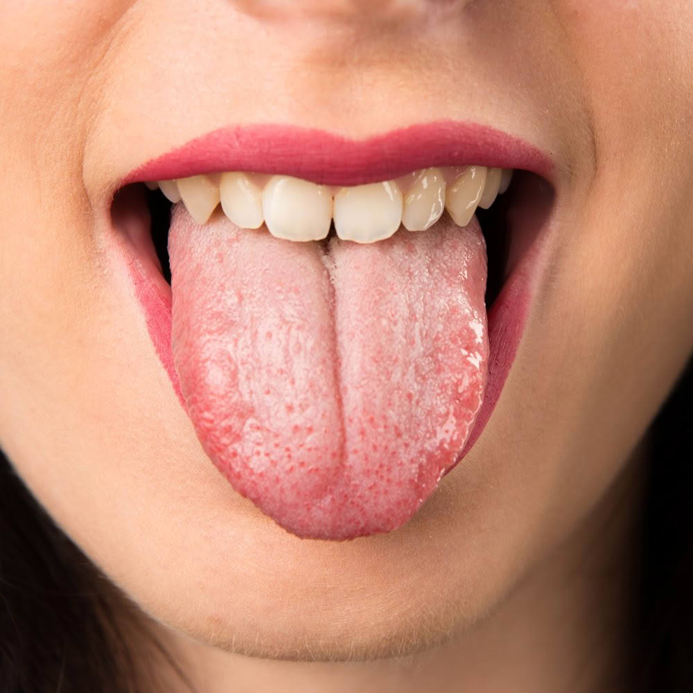 What Do Ps On The Tongue Mean Infoupdate What Do Ps On The Tongue Mean Infoupdate